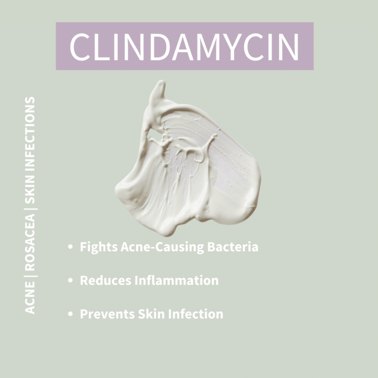Clindamycin Acne Cream Treatment | City Skin Clinic