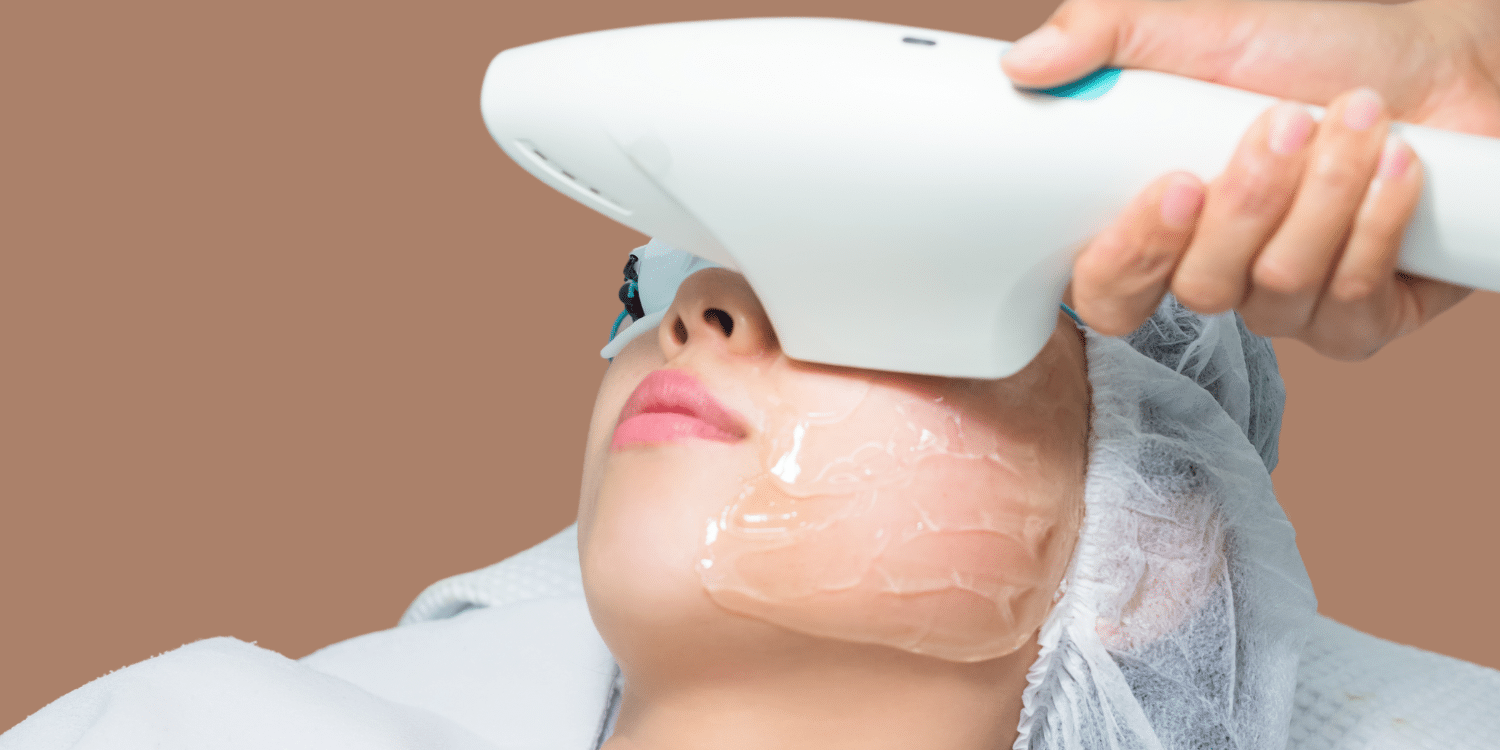 IPL Skin Rejuvenation, The Ultimate Treatment for Flawless Skin?