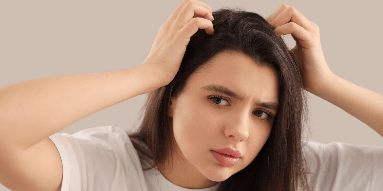 Seborrheic Dermatitis Causes & How to Get Rid of it