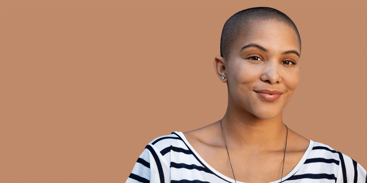 Central Centrifugal Cicatricial Alopecia Diagnosis & Treatment