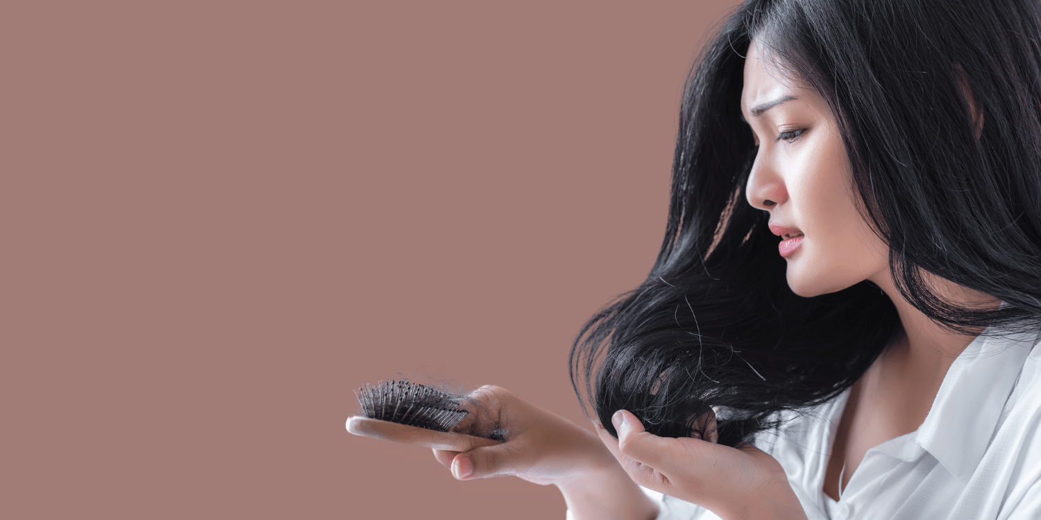 All the Stages of Female Pattern Hair Loss