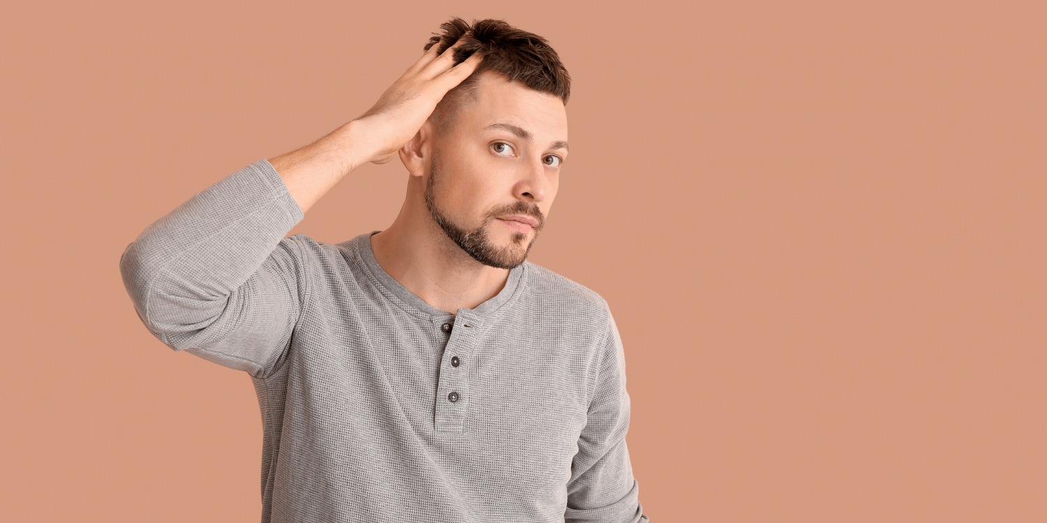 All the Stages of Male Pattern Hair Loss