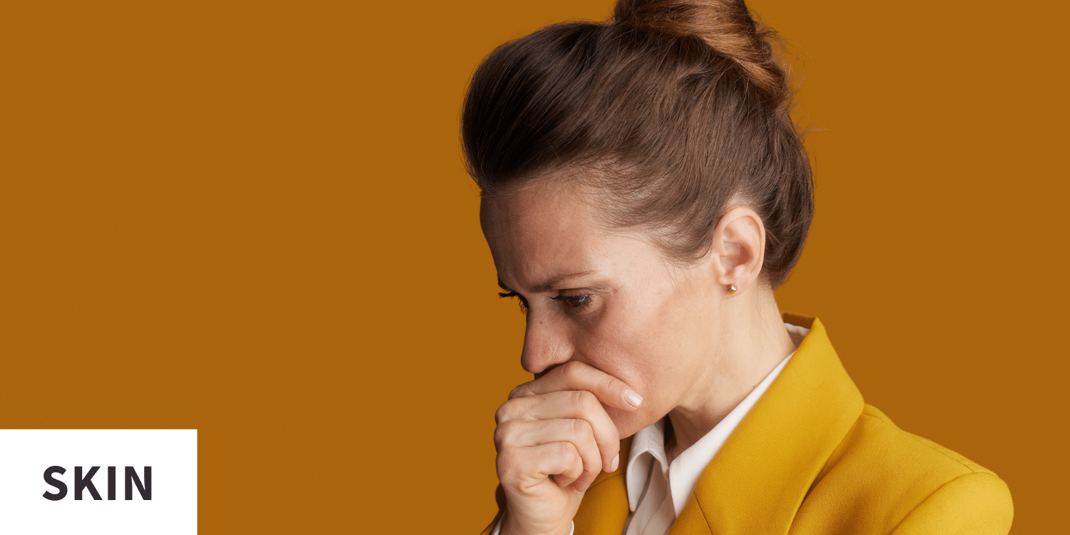 Fordyce Spots: Causes, Pictures and How to Get Rid of Them