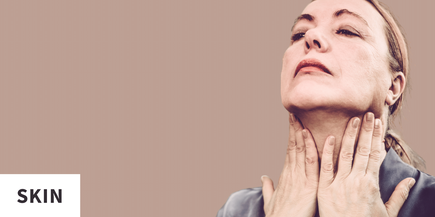 Poikiloderma of Civatte - Causes, Symptoms and Treatment