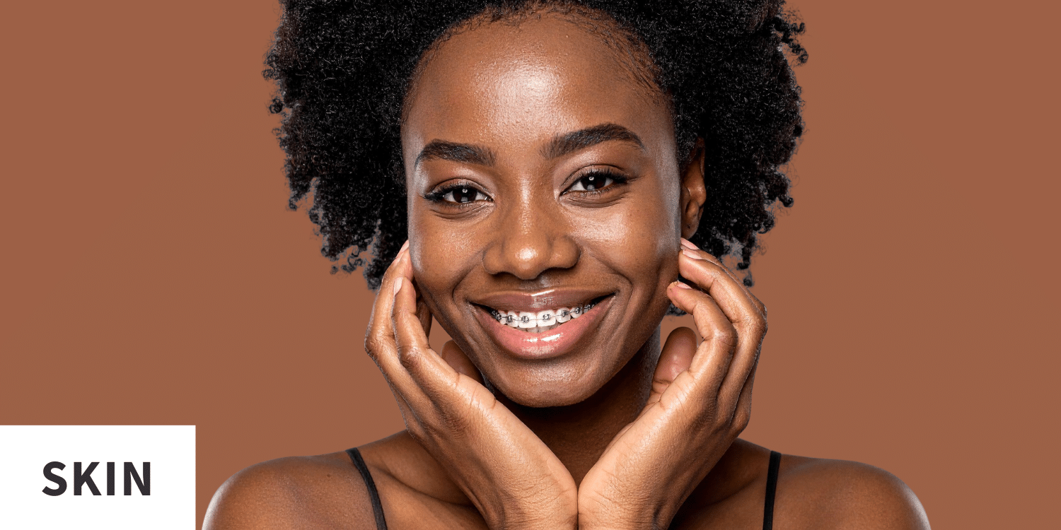 Rash Around Mouth: Is it Perioral Dermatitis, Rosacea or Acne?